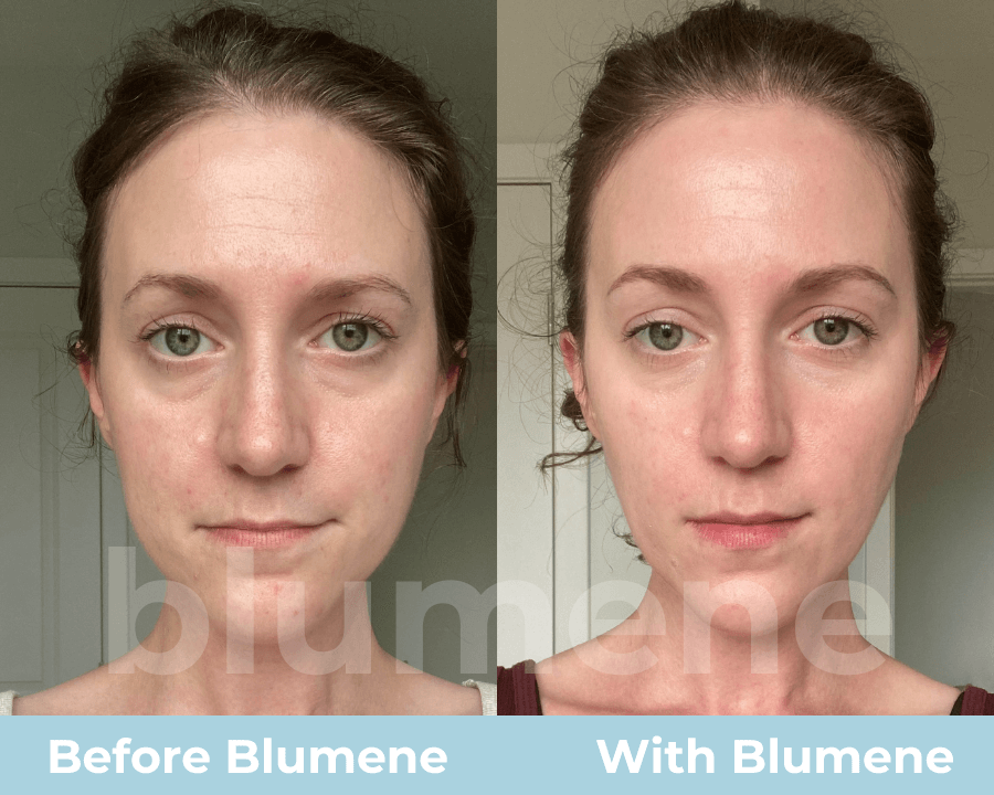 Blumene Face Pro – blumene